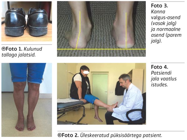 Labajala enamlevinud patoloogiad ja nende käsitlus täiskasvanul | Med24