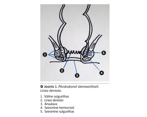 Hemorroidaalveenilaiendid | Med24